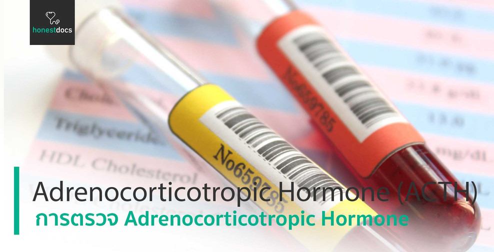 Adrenocorticotropic Hormone Acth Hd สุขภาพดี เริ่มต้นที่นี่
