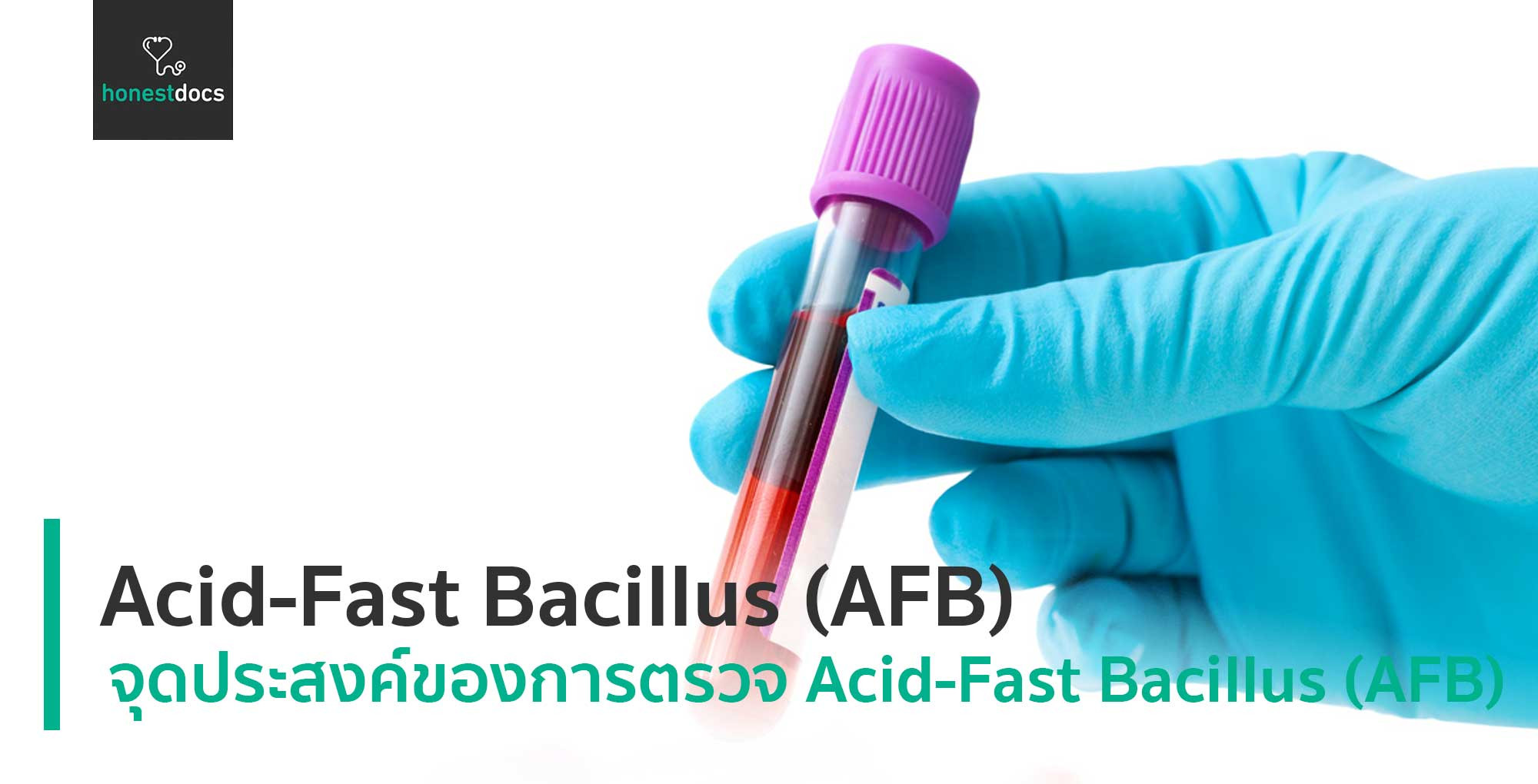Acid-Fast Bacillus (AFB) | HD สุขภาพดี เริ่มต้นที่นี่